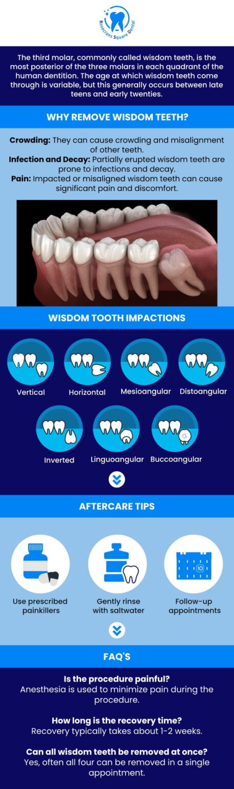 How Long Does Swelling Last After Wisdom Teeth Removal?